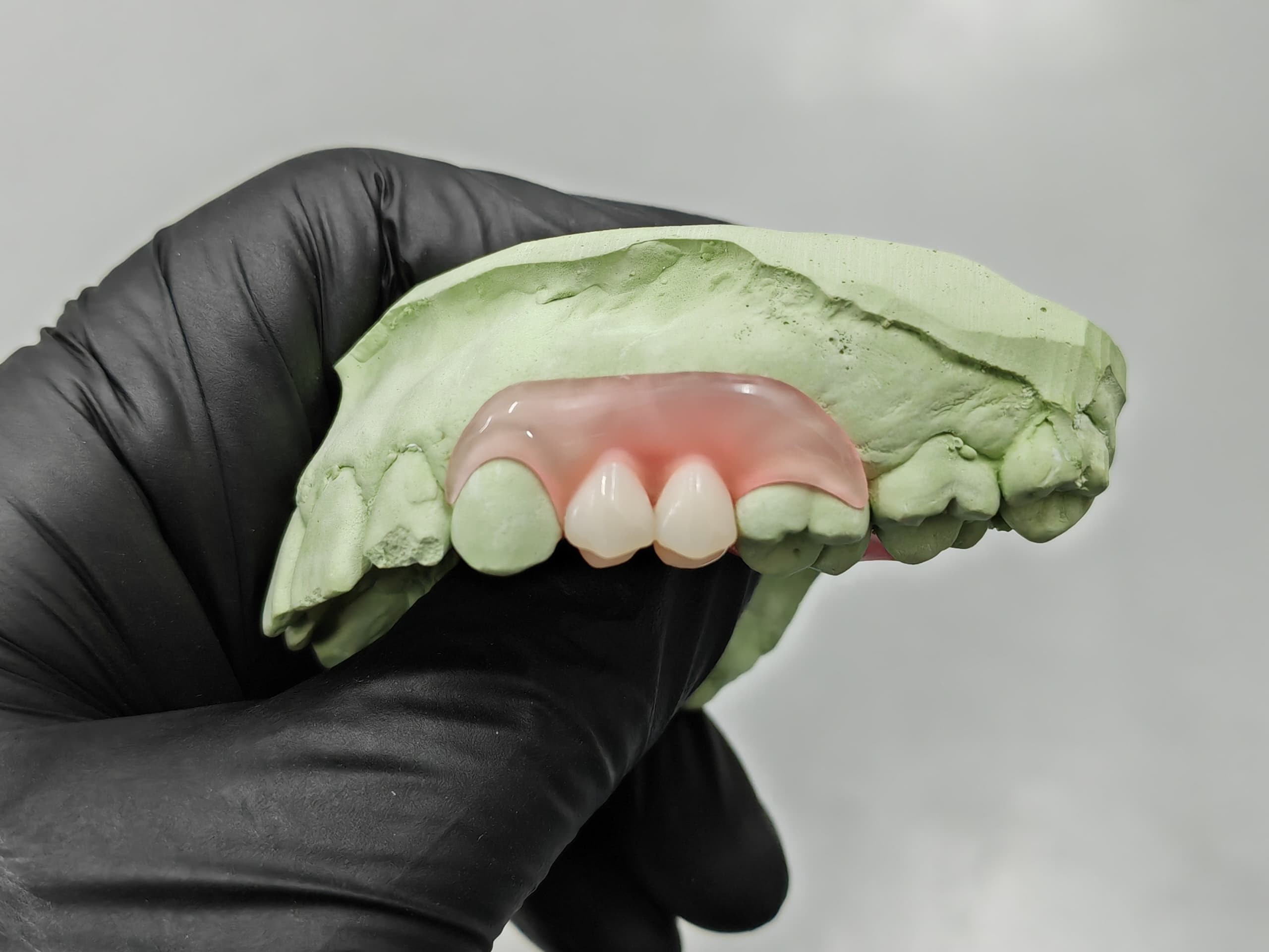 3D Printing Flexible Invisible Denture Base Resin